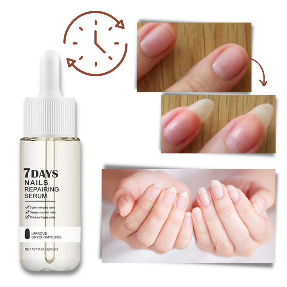 7 Days Nail Repair Essence – Verniershop