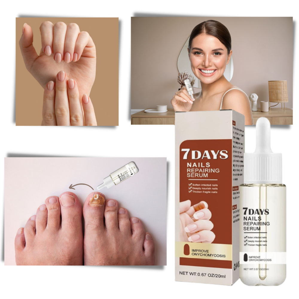 7 Days Nail Repair Essence – Verniershop