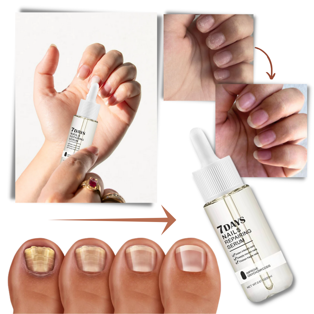 7 Days Nail Repair Essence – Verniershop